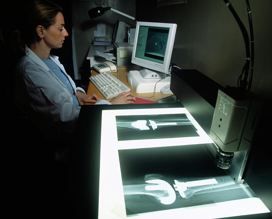 Testing Artificial Knee Photograph by Mauro Fermariello/science Photo ...