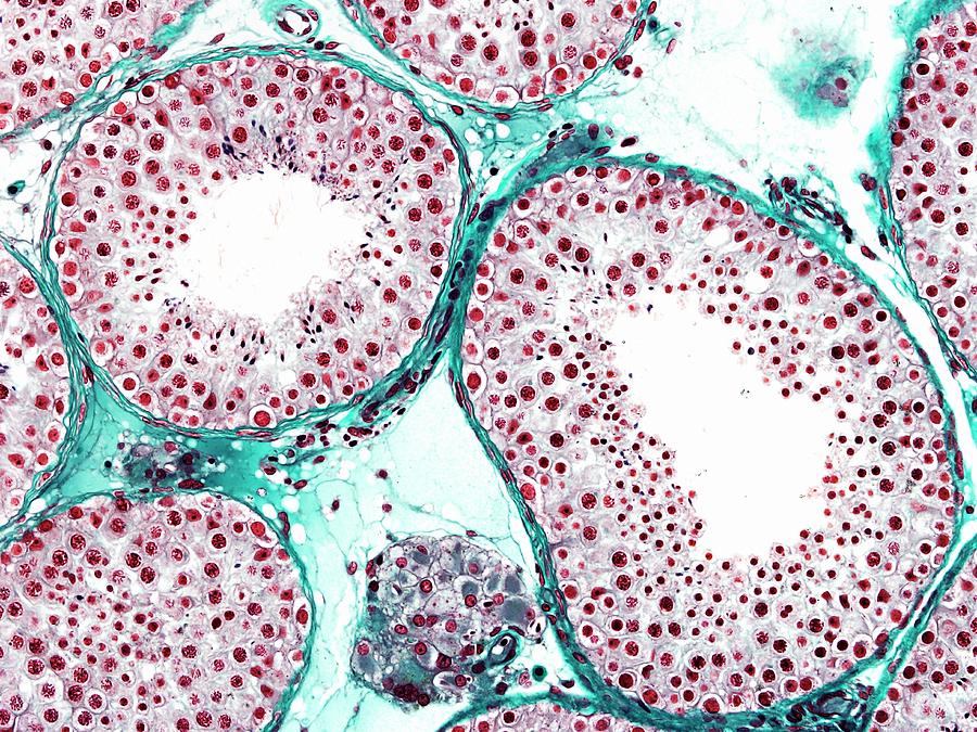 Testis Photograph by Microscape - Fine Art America