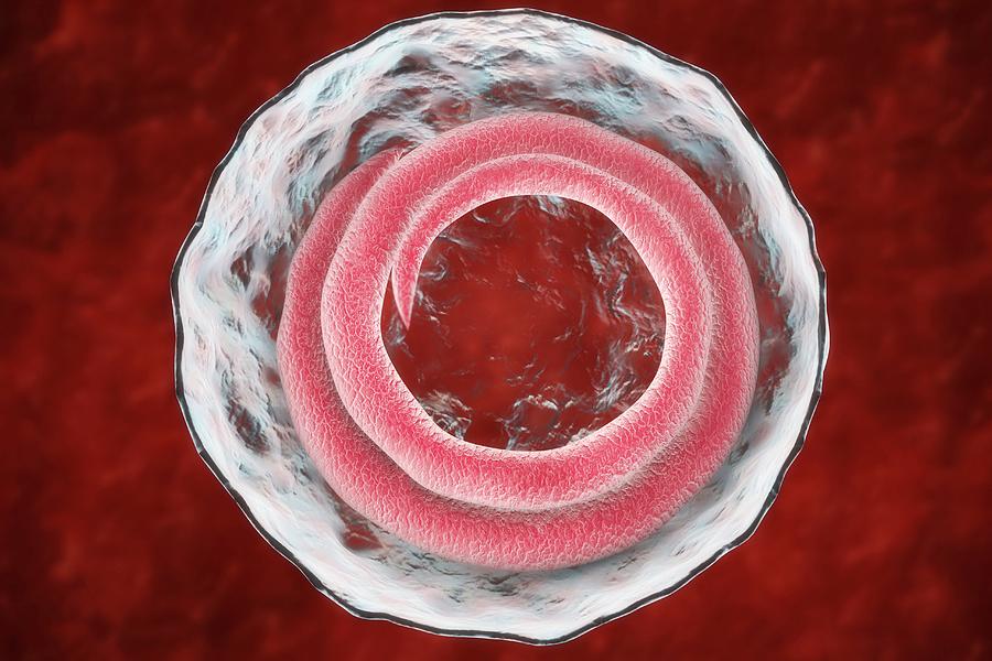 Trichina Roundworm Photograph by Kateryna Kon/science Photo Library