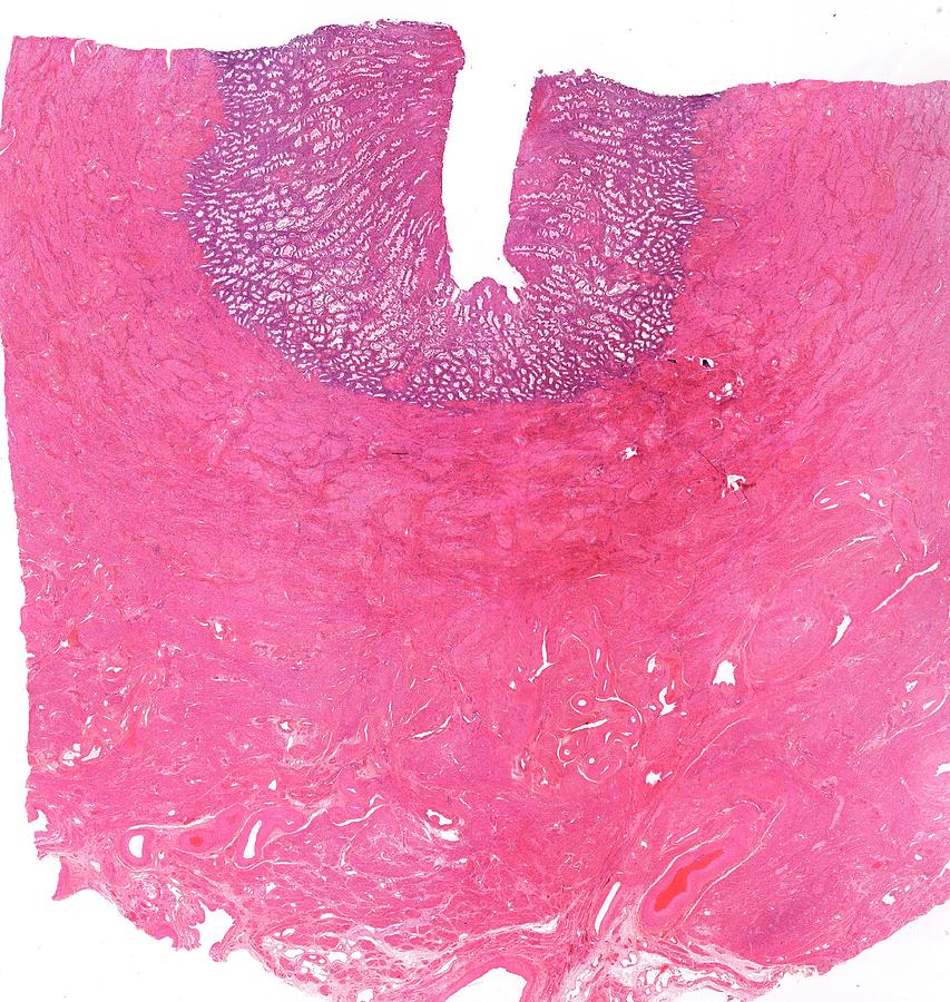 Uterus Photograph by Microscape - Fine Art America