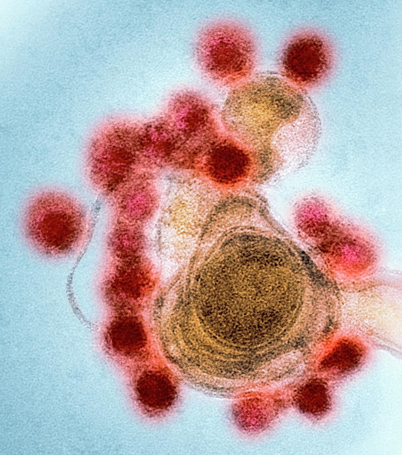 Zika Virus Particles Photograph by National Institutes Of Health, Niaid ...