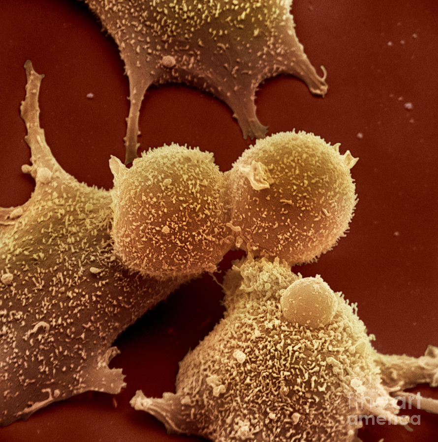Human Fibroblast Cells Photograph by David M. Phillips - Pixels