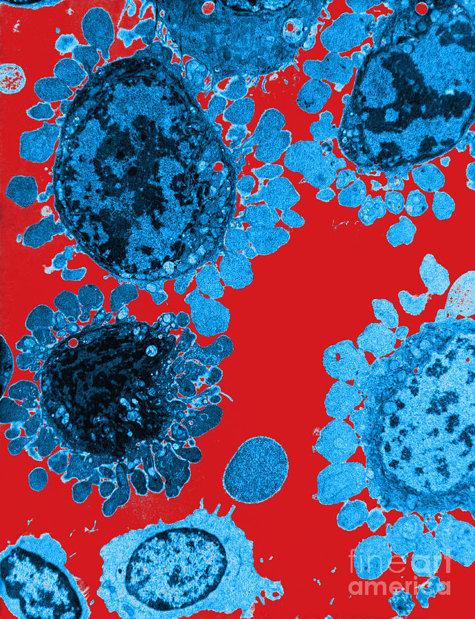 Apoptosis, Human Lymphocyte, Tem Photograph by David M. Phillips - Fine ...