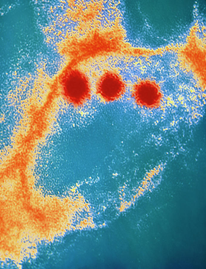Coloured Tem Of Dengue Virus Particles Photograph by London School Of Hygiene And Tropical ...