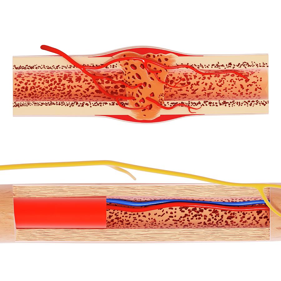 Human Bone Structure Photograph by Pixologicstudio/science Photo ...