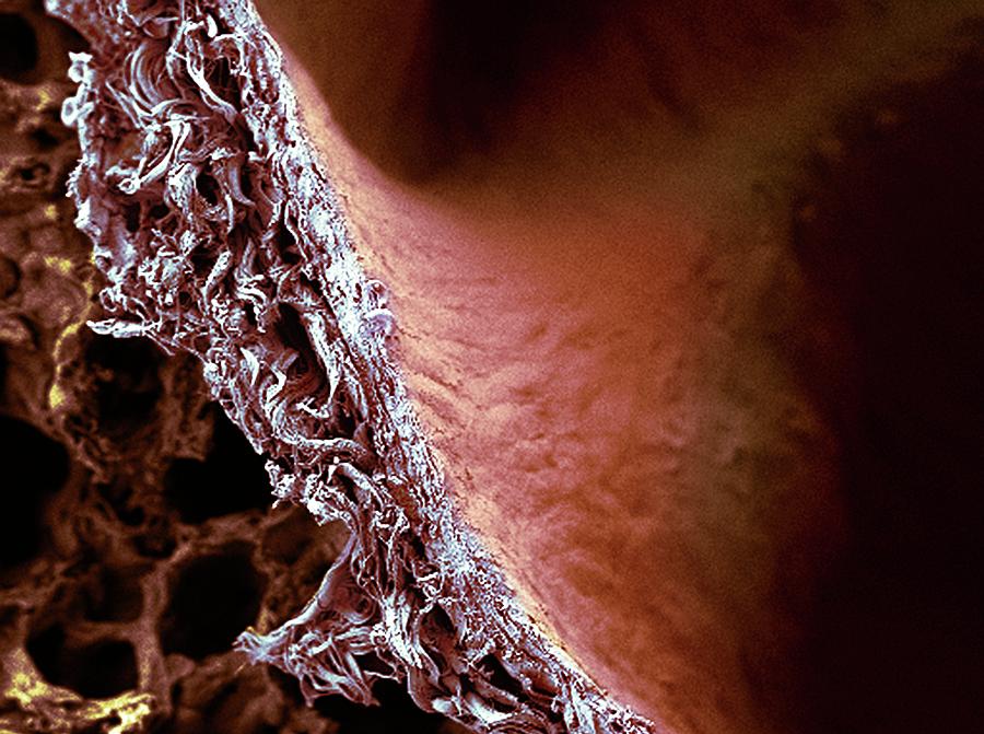 Lung Tissue #3 by Science Photo Library