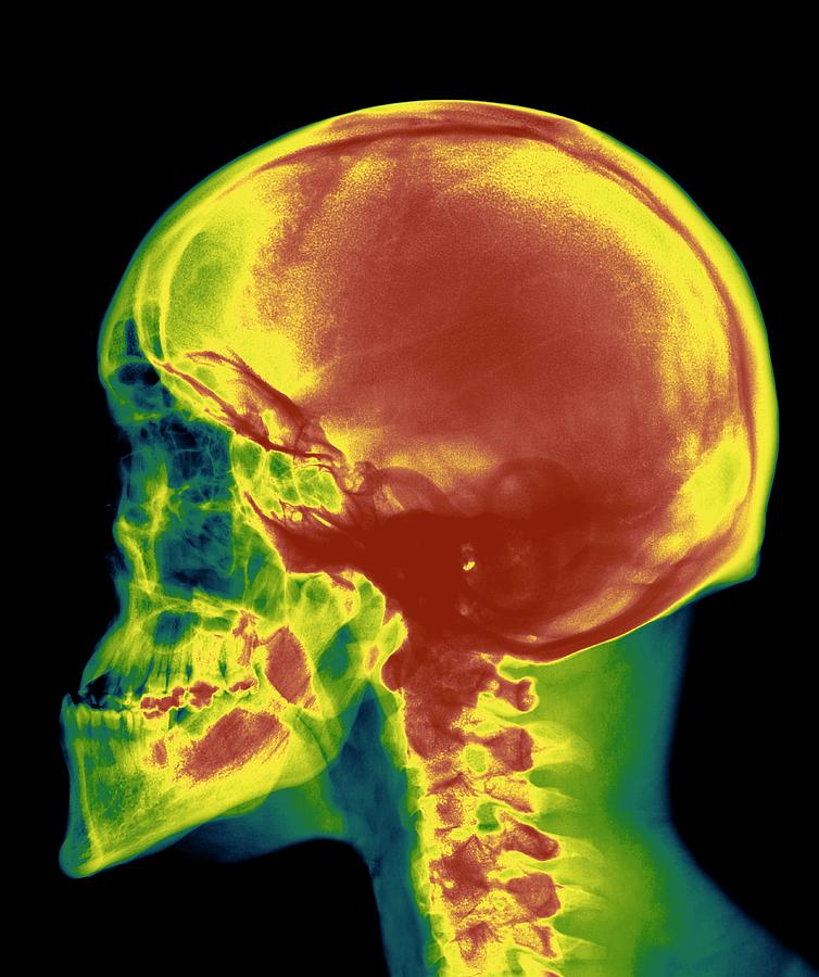 Skull #3 by Science Photo Library
