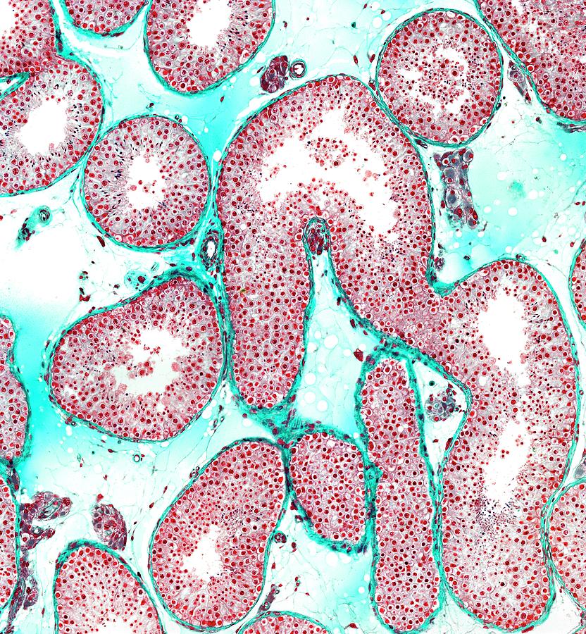 Testis Photograph by Microscape - Fine Art America