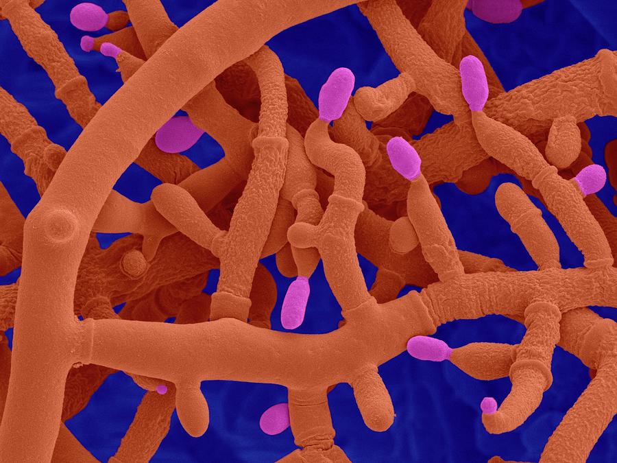 Trichoderma Citrinoviride Endophytic Fungus #3 by Science Photo Library