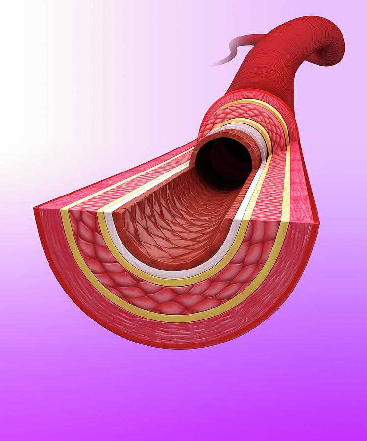 Human Artery #34 by Pixologicstudio / Science Photo Library