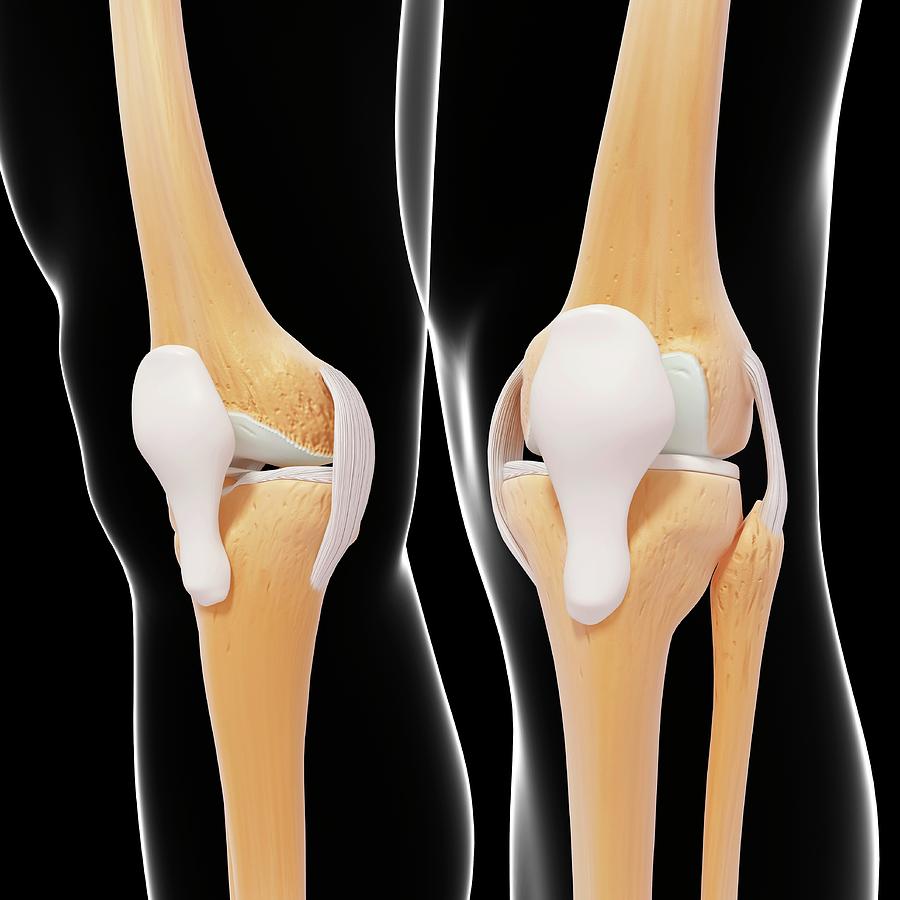 Human Leg Bones Photograph by Pixologicstudio/science Photo Library ...
