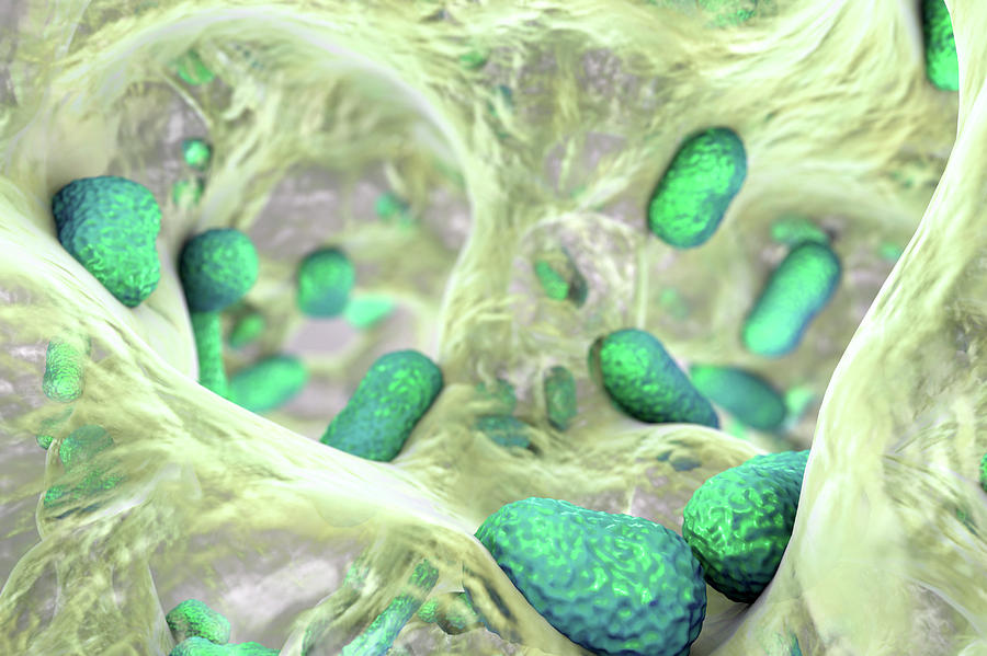 Acinetobacter Baumannii Bacteria Photograph by Kateryna Kon/science ... Acinetobacter Baumannii Bacteria Photograph by Kateryna Kon/science ...