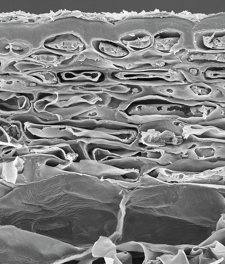 Apple Fruit Section Photograph by Dennis Kunkel Microscopy/science ...