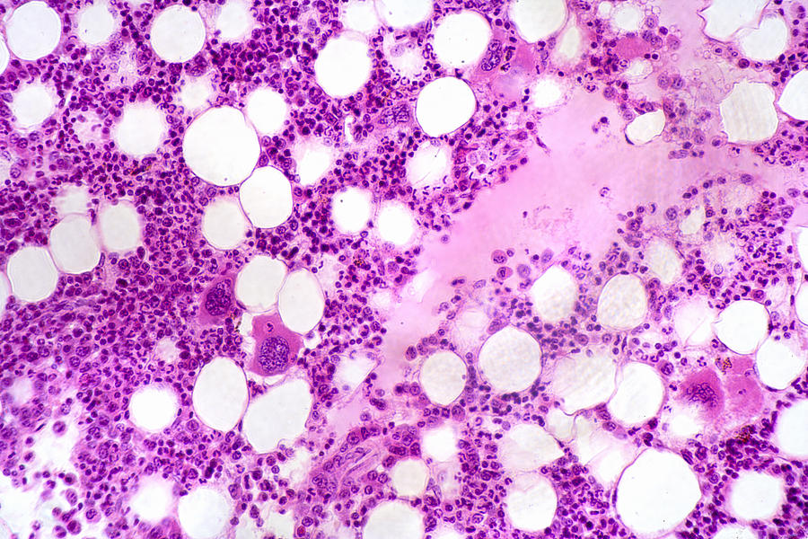 Bone Marrow Section, Lm Photograph by Science Stock Photography | Pixels Bone Marrow Section, Lm Photograph by Science Stock Photography | Pixels
