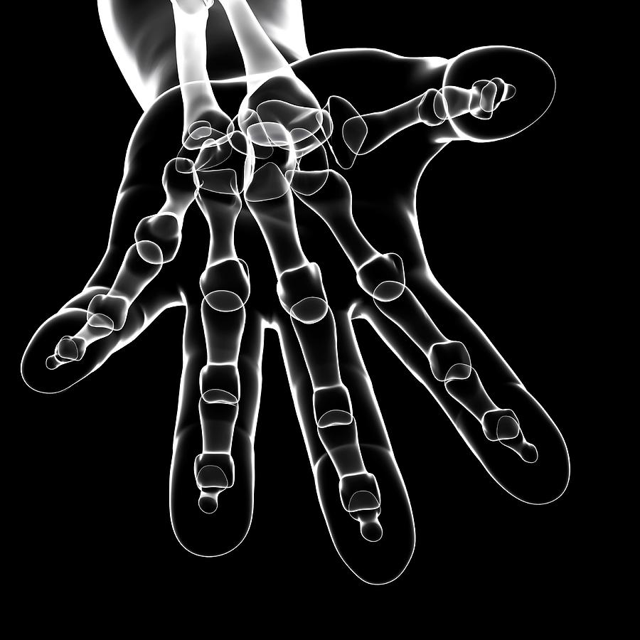 Human Hand Bones Photograph by Pixologicstudio/science Photo Library ...
