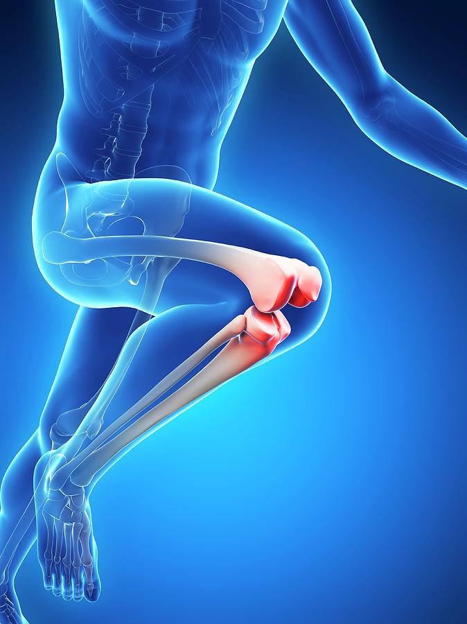 Runner's Knee Joint Photograph by Sebastian Kaulitzki - Fine Art America