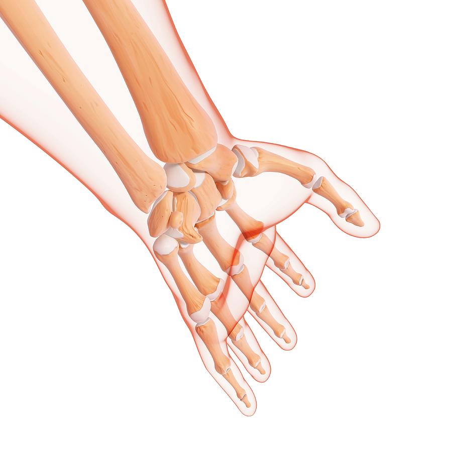 Human Hand Bones Photograph by Pixologicstudio/science Photo Library ...