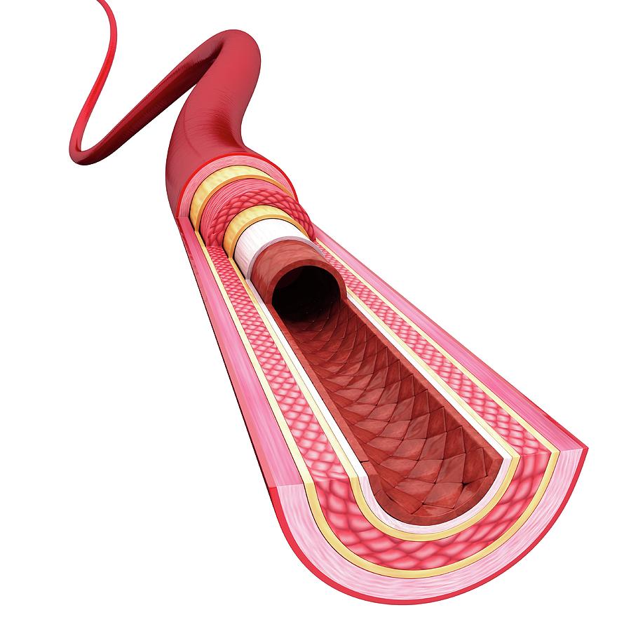 Human Artery #48 by Science Photo Library