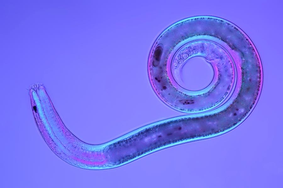 Nematode #5 by Science Photo Library