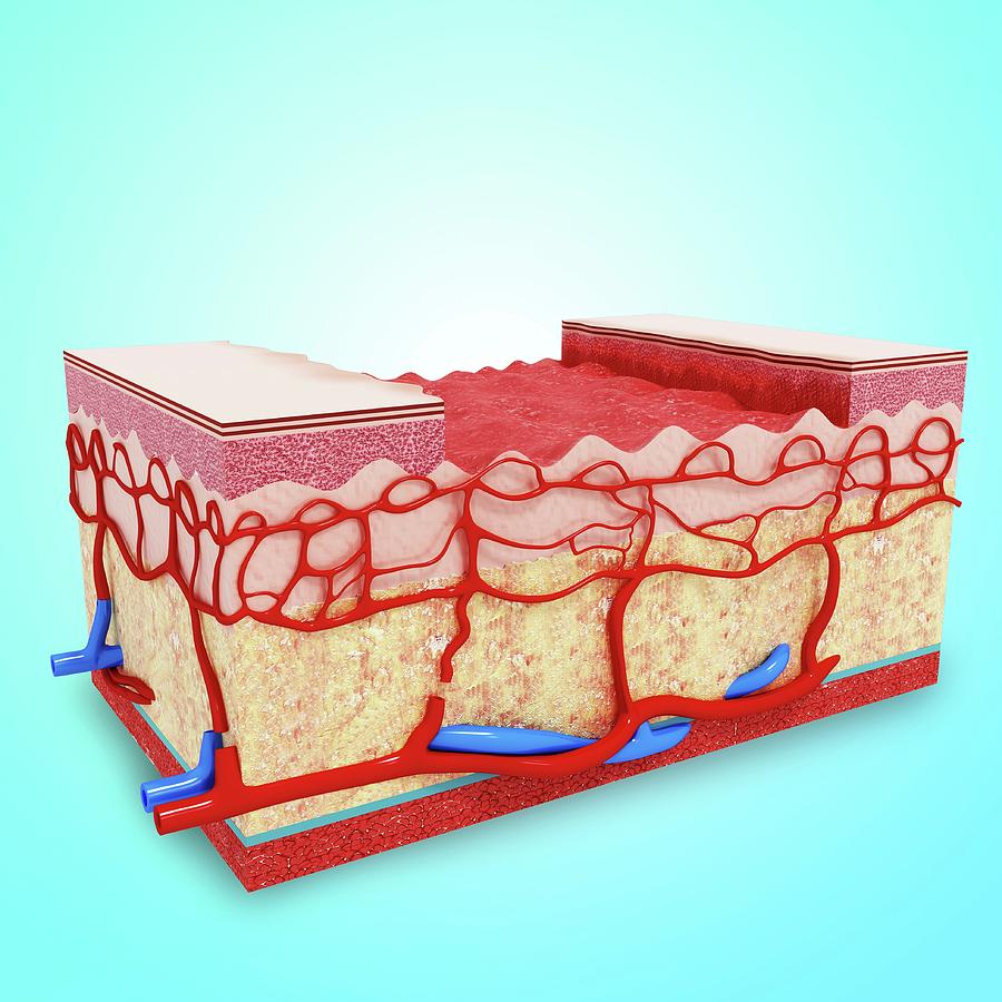 Human Skin Anatomy #58 Photograph by Pixologicstudio/science Photo ...