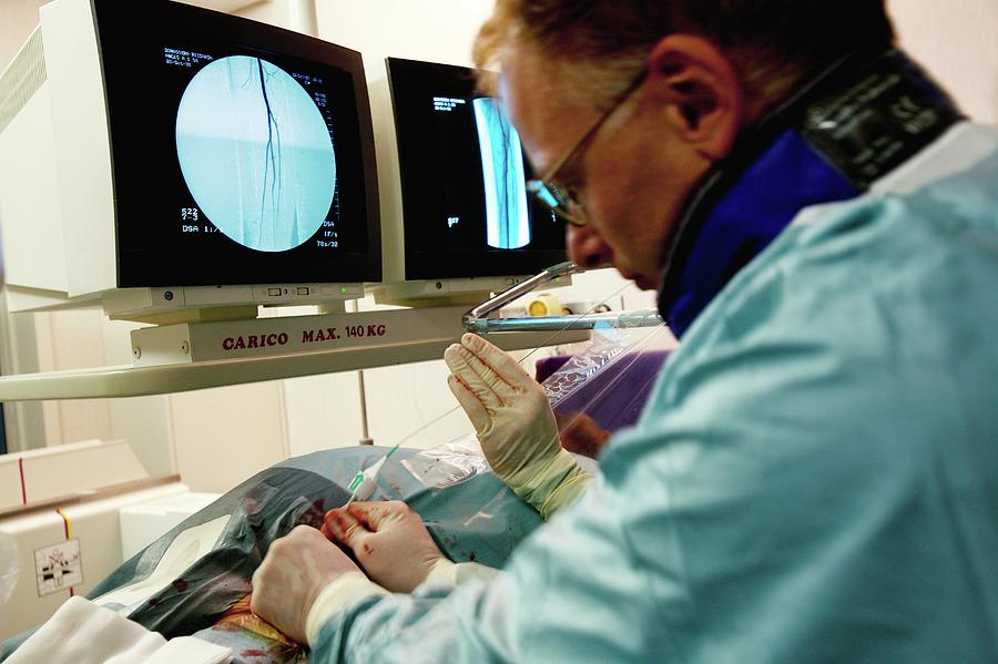 Angiography Photograph By Mauro Fermarielloscience Photo Library Pixels