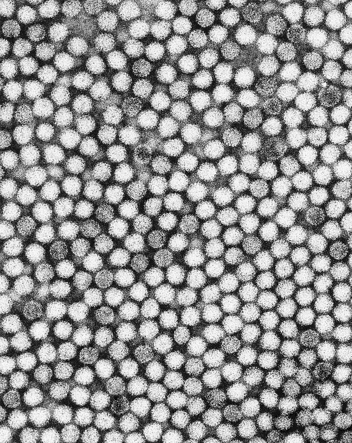 Hepatitis B Virus Photograph By Dennis Kunkel Microscopy Science Photo