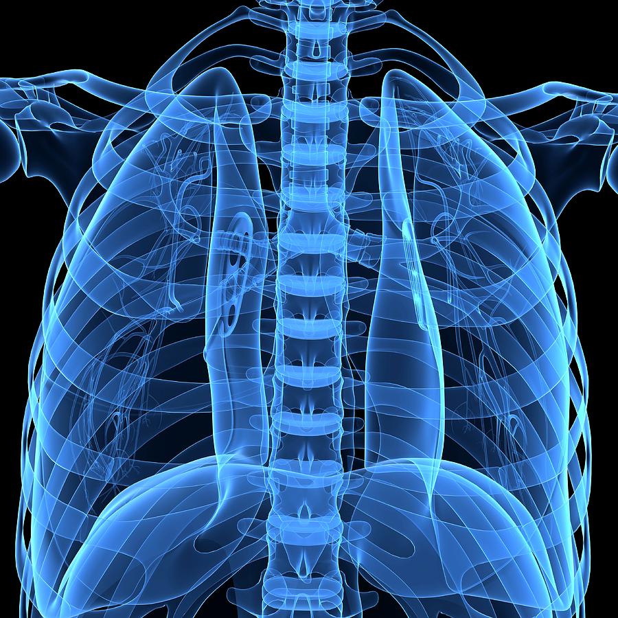 Human Lungs #6 by Science Photo Library