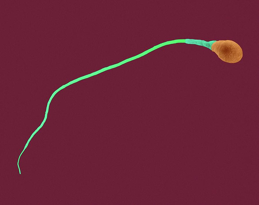 Human Sperm Photograph by Dennis Kunkel Microscopy/science Photo ...