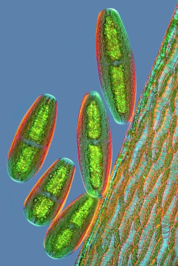Netrium Desmids #6 by Science Photo Library