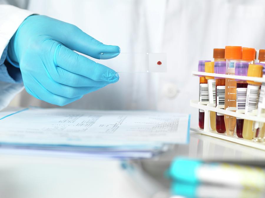 Blood Testing #7 by Tek Image / Science Photo Library