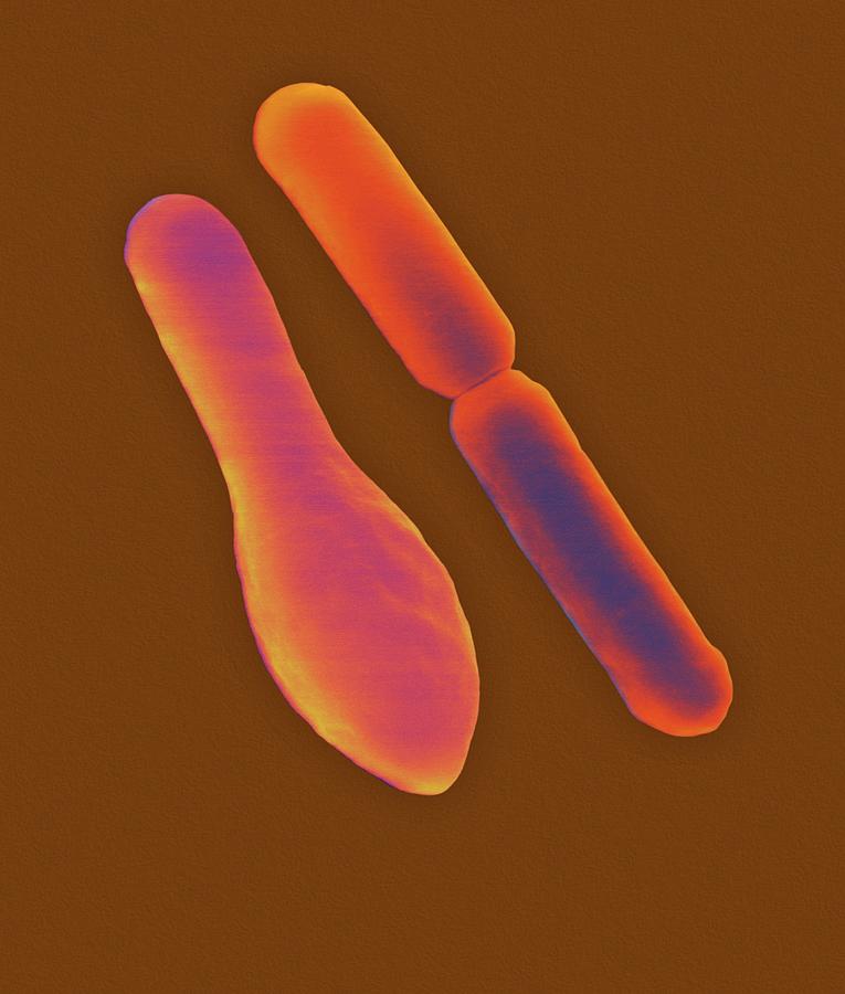 Clostridium Sporogenes Photograph By Dennis Kunkel Microscopyscience Photo Library Pixels