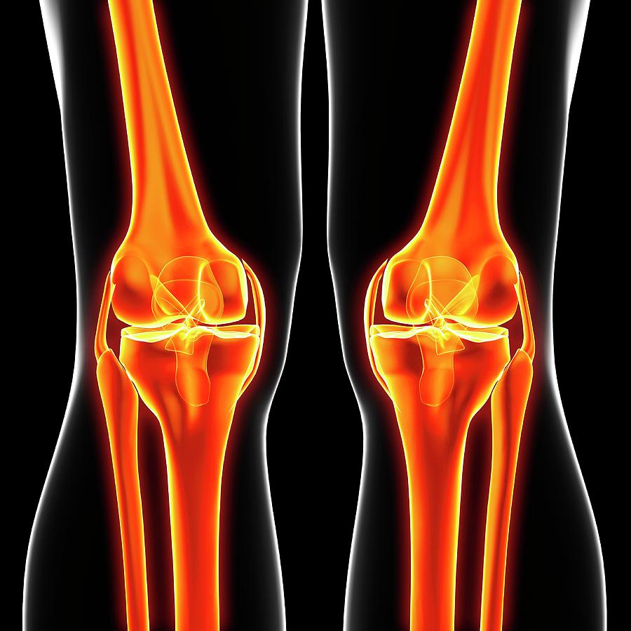 Human Leg Bones #71 by Science Photo Library