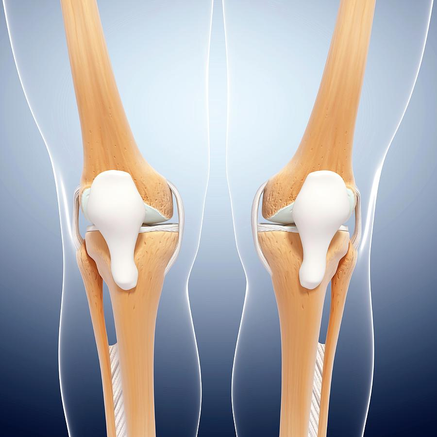 Human Leg Bones #72 by Pixologicstudio / Science Photo Library