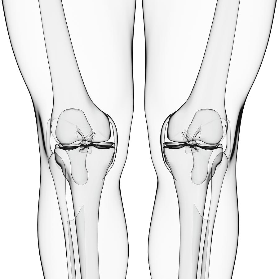 Human Leg Bones Photograph by Pixologicstudio/science Photo Library ...