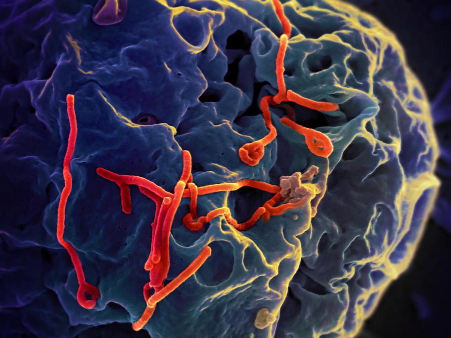 Ebola Virus, Sem Photograph by Science Source - Fine Art America Ebola Virus, Sem Photograph by Science Source - Fine Art America
