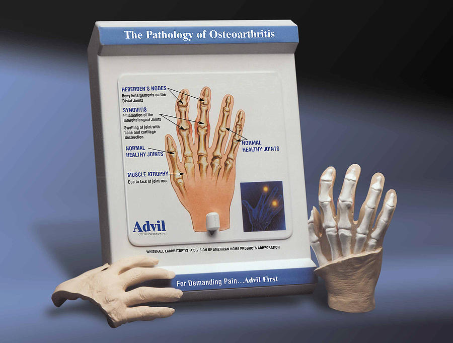 Advil Sculpture by Harold Shull - Pixels