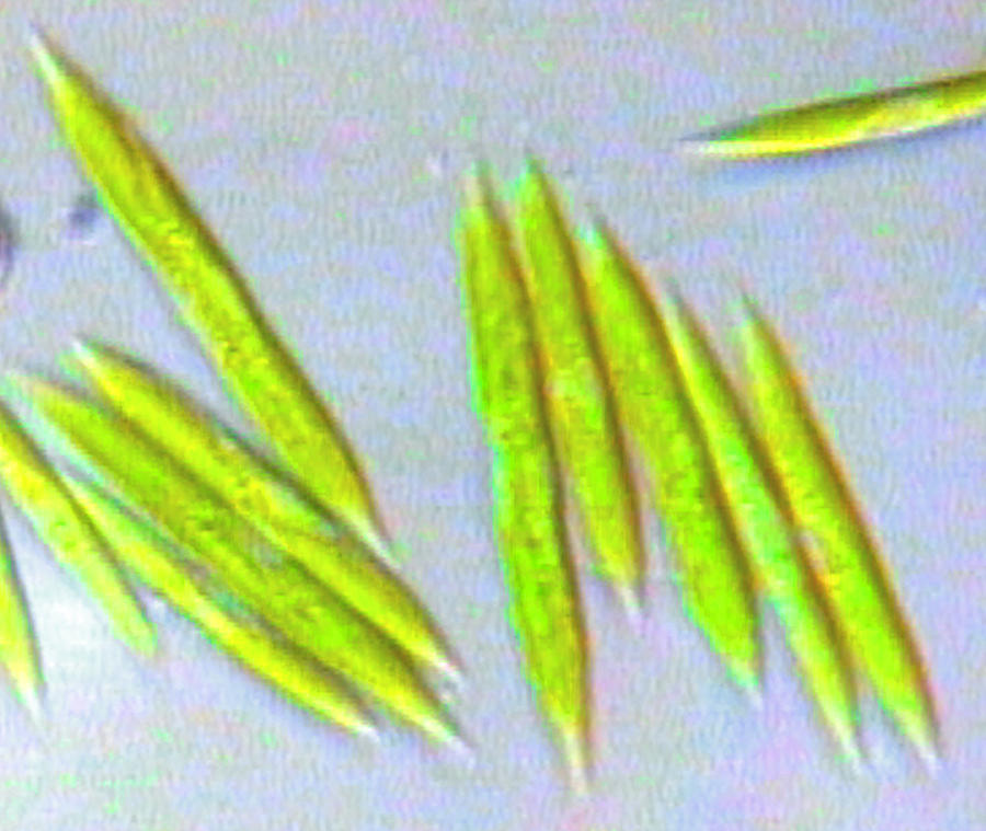 Algae 7 Digital Art by Robert Slusher - Fine Art America