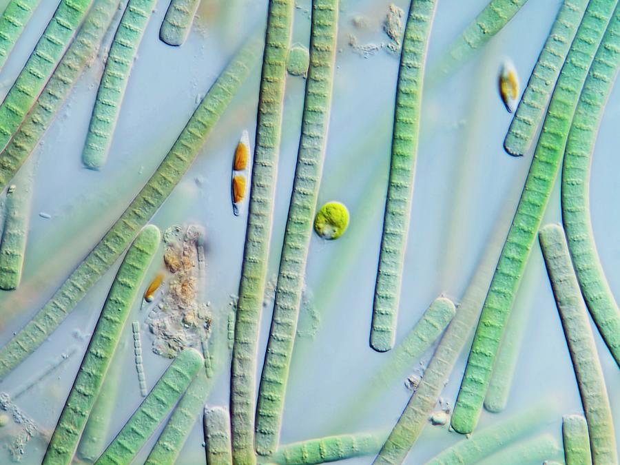 Algae by Science Photo Library
