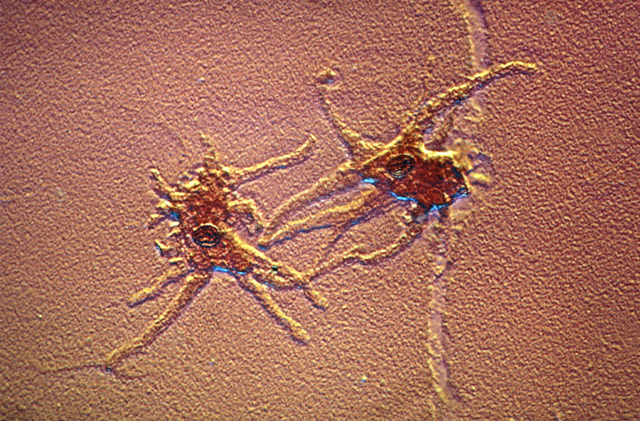 Amoebae Photograph by Perennou Nuridsany - Pixels