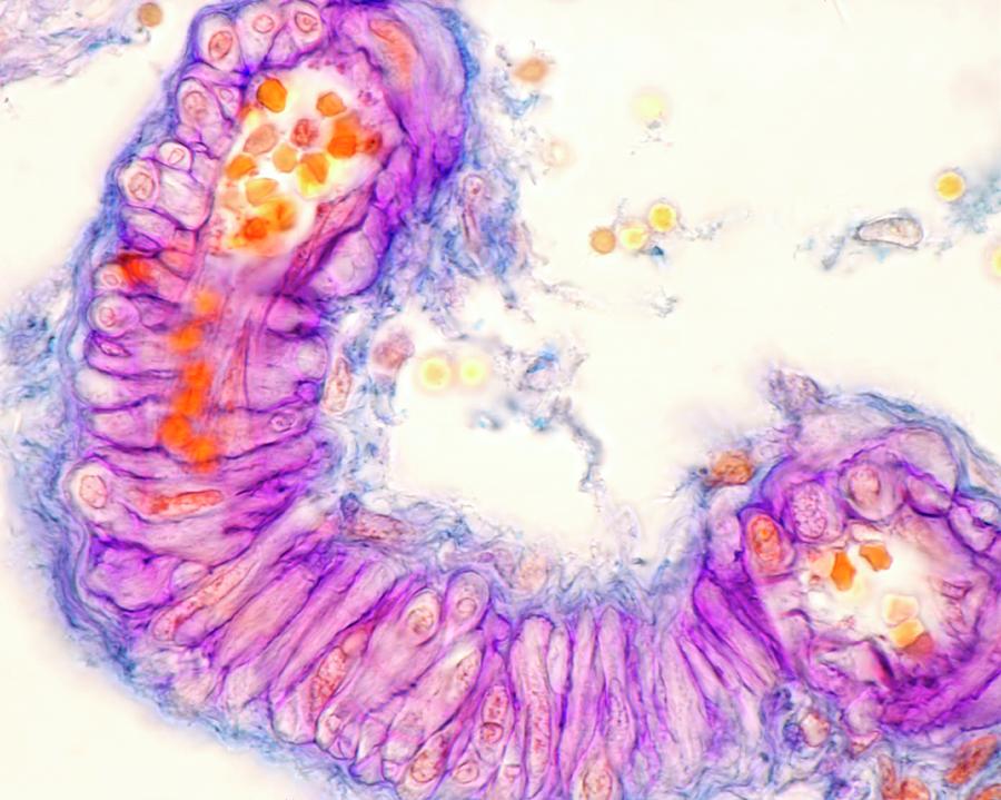 Arteriole Smooth Muscle Cells Photograph by Jose Calvo / Science Photo ... Arteriole Smooth Muscle Cells Photograph by Jose Calvo / Science Photo ...