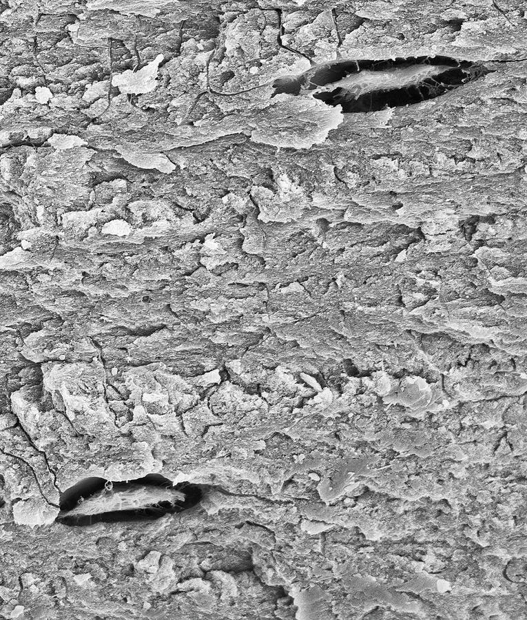 Bone Cells (osteocytes) In Compact Bone Photograph by Dennis Kunkel ...