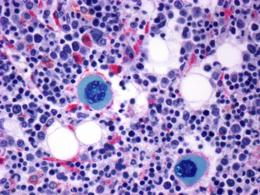 Bone Marrow Photograph by Science Photo Library - Pixels