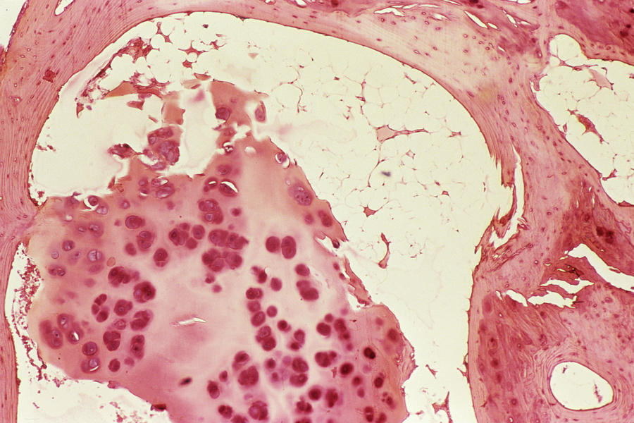 Cartilage Photograph by Cnri/science Photo Library