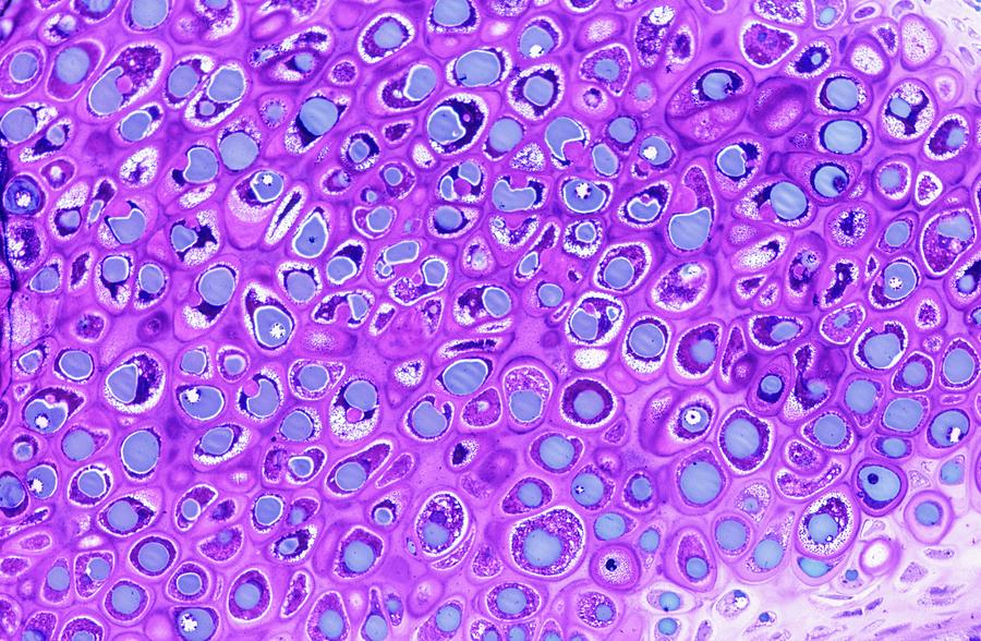 Cartilage by Science Photo Library