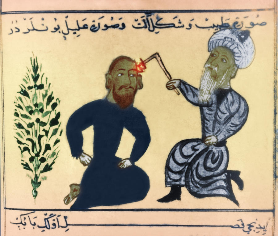 Cauterizing A Wound Photograph by Science Source - Pixels