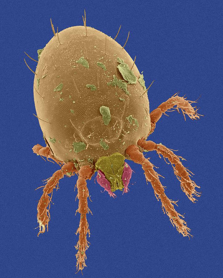 Chigger (trombicula Sp.) Photograph by Dennis Kunkel Microscopy/science ... Chigger (trombicula Sp.) Photograph by Dennis Kunkel Microscopy/science ...