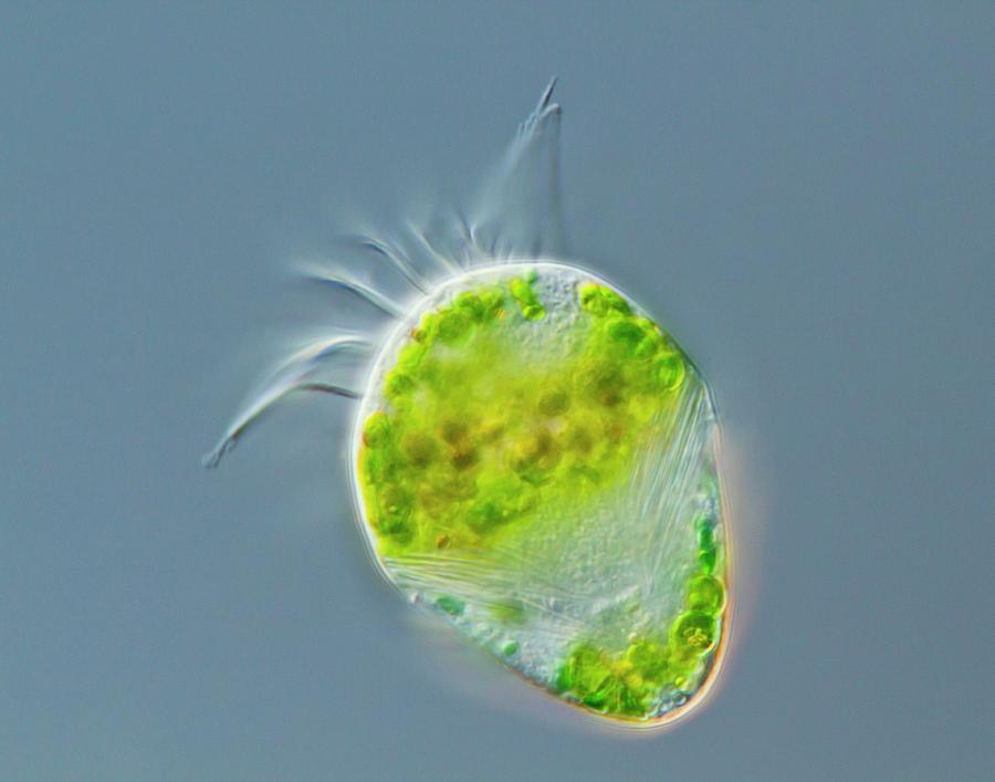 Ciliate Protozoan Photograph By Gerd Guentherscience Photo Library