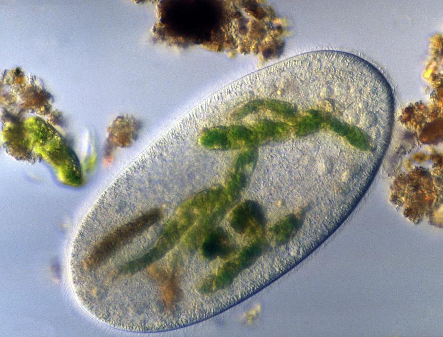 Ciliate With Ingested Prey Photograph by Clouds Hill Imaging Ltd - Fine ...