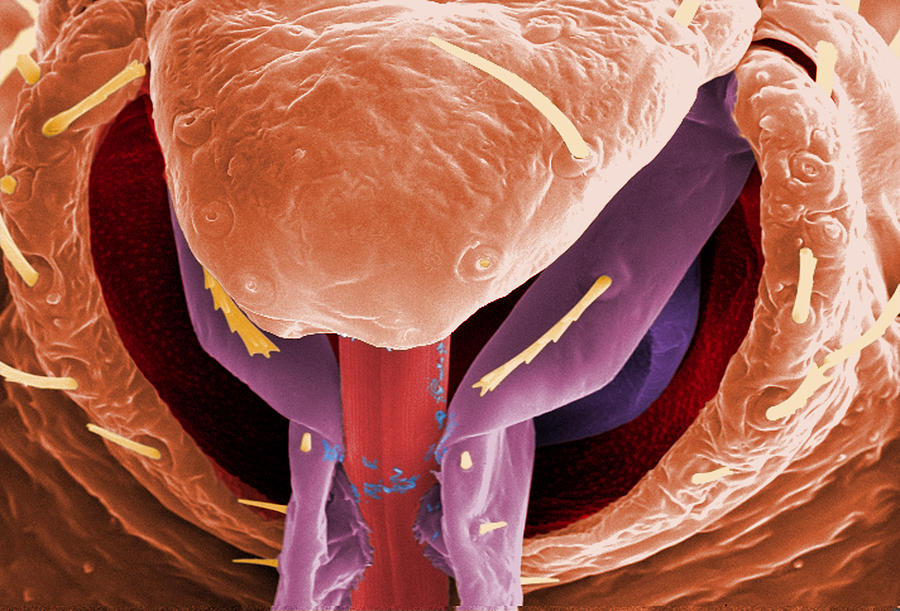 Cimex Lectularius, Bed Bug, Sem by Science Source