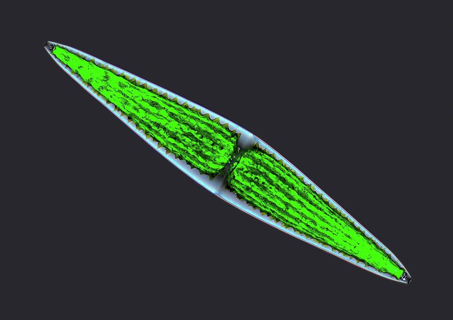 Closterium Desmid Photograph by Rogelio Moreno/science Photo Library